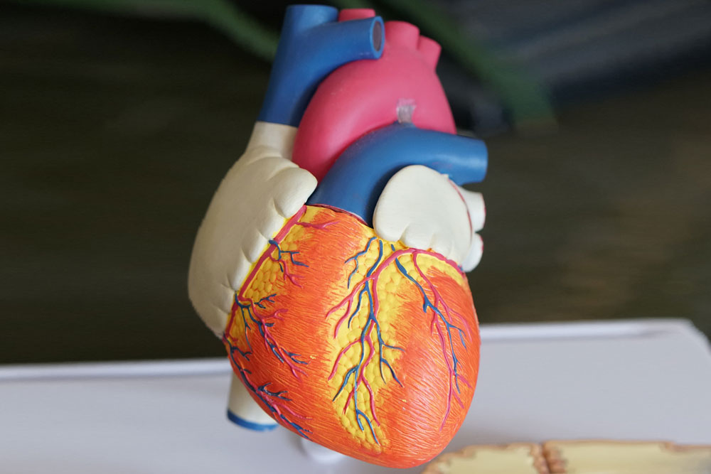 Mitral Valve Prolapse (MVP) - Cardiovascular Interventions Orlando